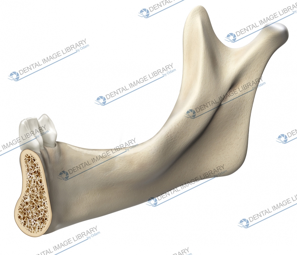 Sagittal section of lower jaw with posterior edentulous ridge ...