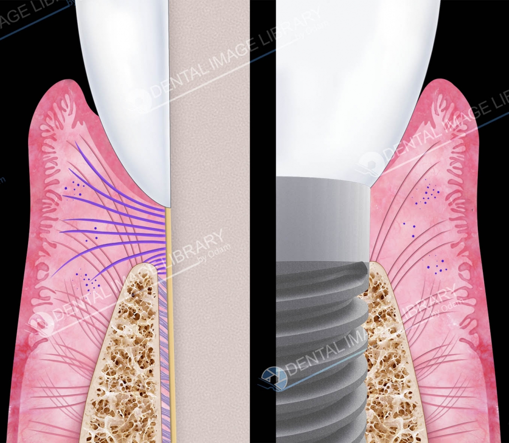 Occlusal view of the anterior maxillary sextant with horizontal tissue ...