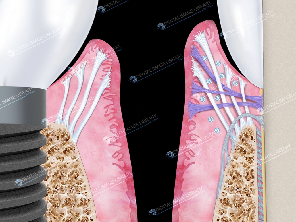 Tooth and implant attachment to surrounding tissue. 62JB00014 | Dental ...