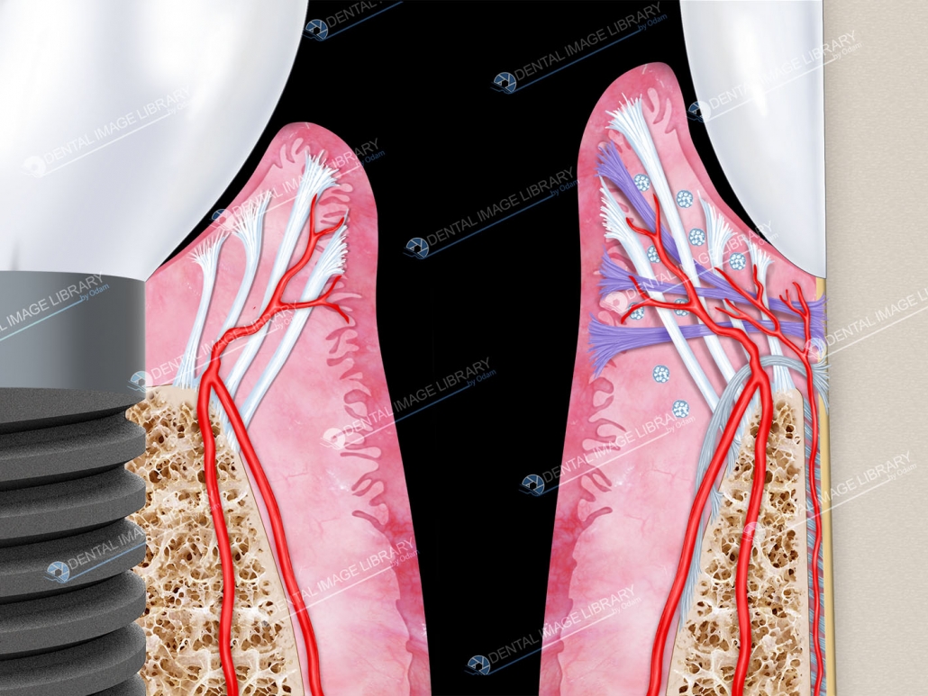 Collection step-by-step illustrations. Buccal and palatal flap design ...