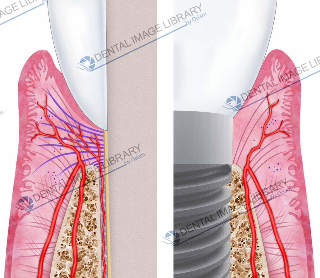 Gingival vessels of natural tooth versus dental implant. 62JW00011 ...