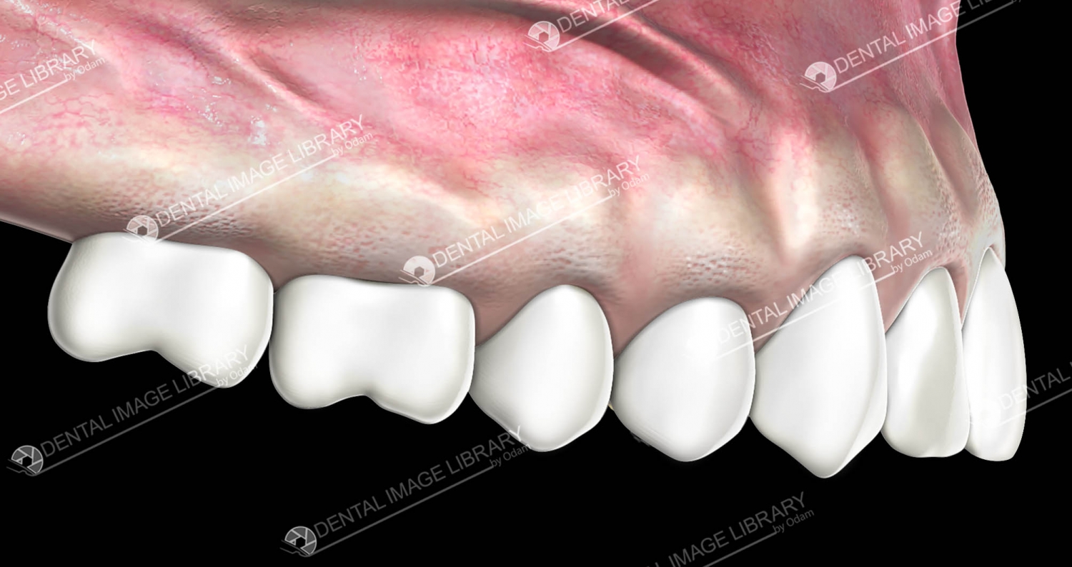 Lateral view of upper teeth with gums. 11JB00082 | Dental Image Library