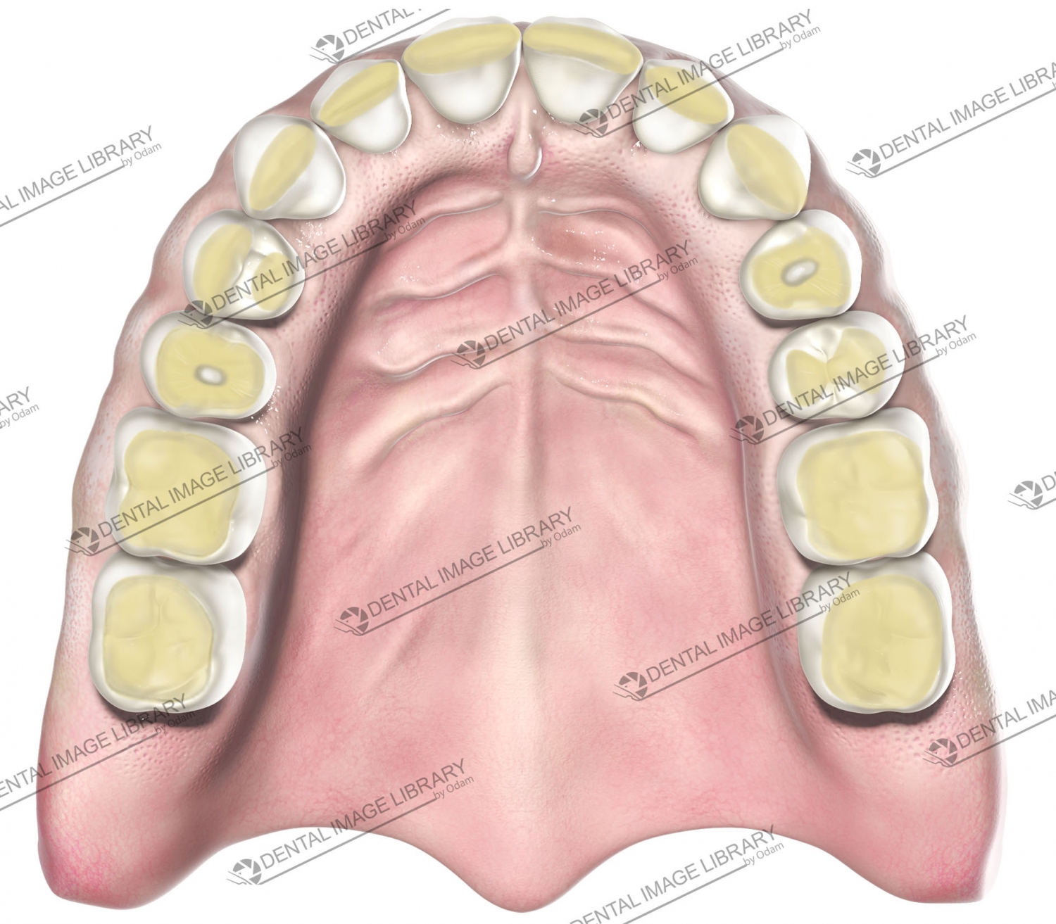 Occlusal view of worn upper teeth. 21JW00020 | Dental Image Library